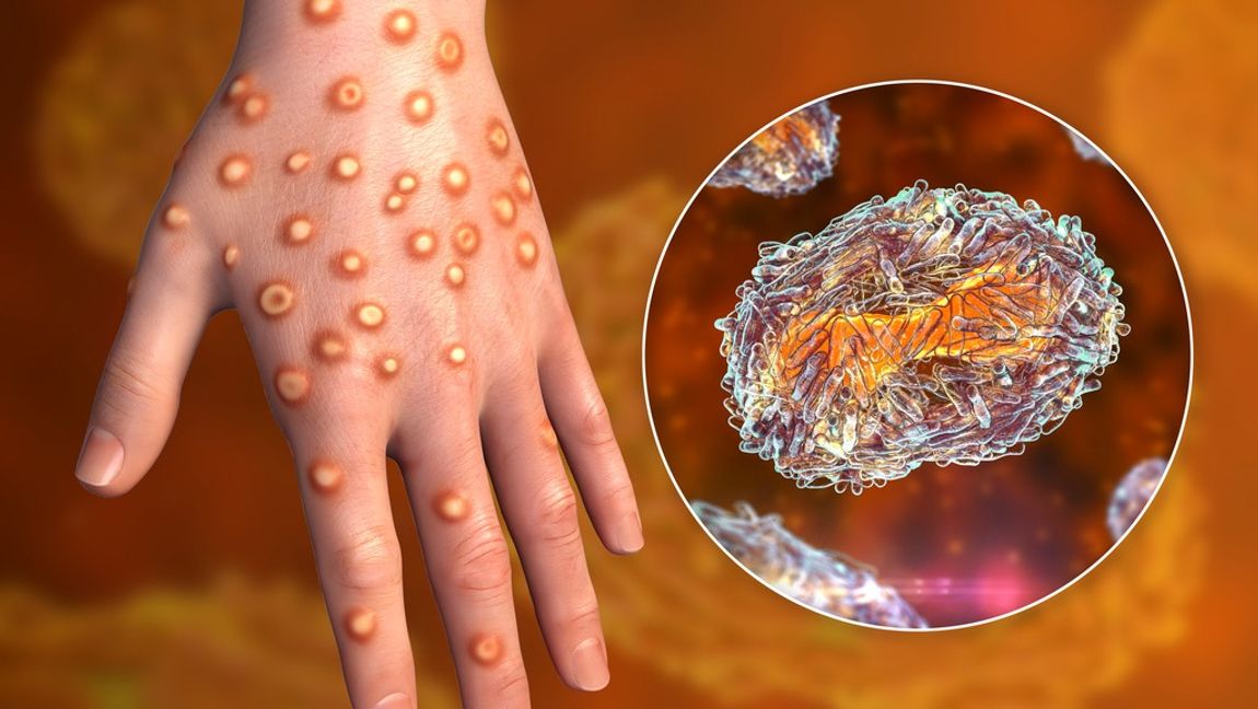 Ap-koppor byter namn